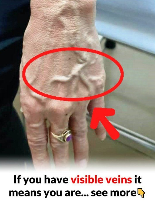 Visible Veins: Common Causes, Potential Risks, and Signs to Watch ...